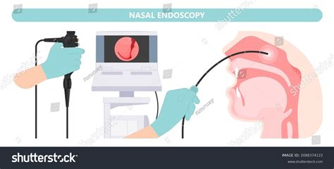 12 Nasoendoscopy 이미지 스톡 사진 및 벡터 Shutterstock