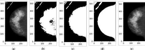 Figure 3 From A Hybrid Workflow Of Residual Convolutional Transformer Encoder For Breast Cancer