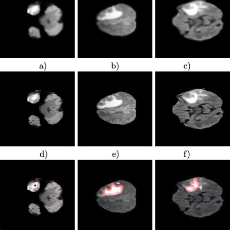 Sample Image Results With Brats Dataset A Input Image 1 B Input