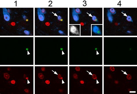 The Appearance Of Tunel Staining Neun Immunoreactivity And Dapi In Download Scientific