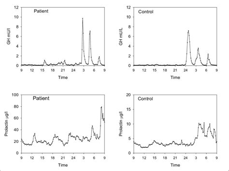 Plasma Gh And Prolactin Profiles Obtained By Blood Sampling At 10 Min