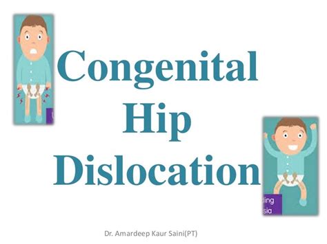 Congenital Hip Dislocation