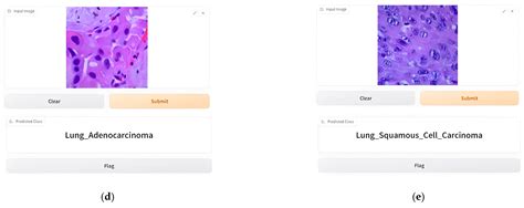 An End To End Lightweight Multi Scale Cnn For The Classification Of Lung And Colon Cancer With