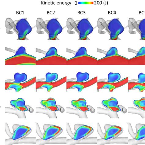 Contours Through Aneurysm Model Colored With Ke Within Each Ia Rows