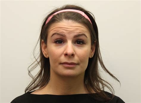 Botulinum Toxin Before And After Photos By James Lee Md Laval Qc