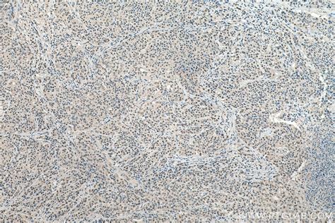 Exosc10 Antibody 16731 1 Ap Proteintech