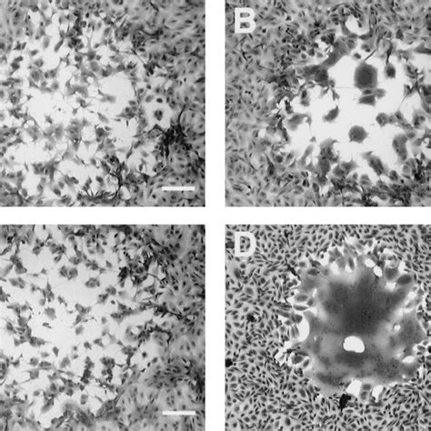 Syncytium Formation By Rvvs Expressing The F And H Genes Of Rpv Bs C 1