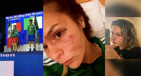 Boxeadora Transgénero Es Descalificada De Campeonato Por Su Alto índice De Testosterona