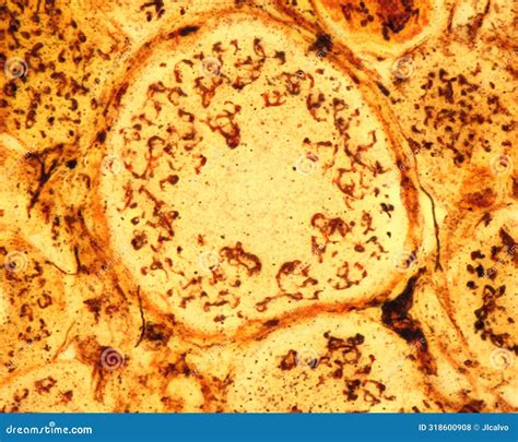 Dorsal Root Ganglion Neurons Golgi Apparatus Stock Photo Image Of