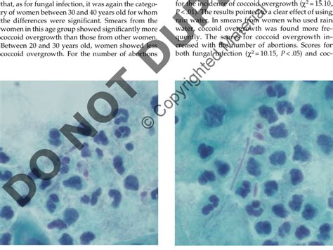 Candida Spores And Pseudohyphae In A Smear Note The Intense Red Download Scientific Diagram
