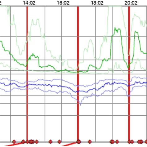 Facial Expression Based Model Of The Iprognosis App For Detection Of