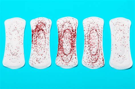 What Does Implantation Bleeding Discharge Look Like