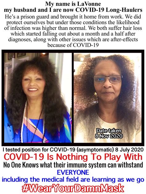 I Was Diagnosed Asymptomatic In The Early Part Of July I Started Losing My Hair All Over My