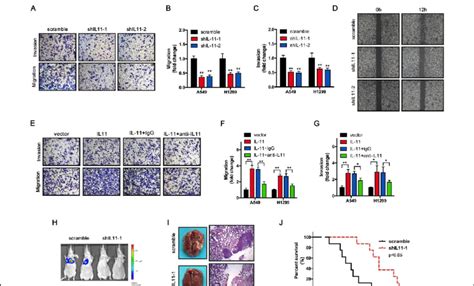 Il 11 Promotes Nsclc Cell Invasion And Migration In Vitro And Lung