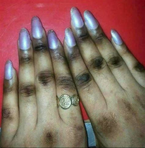 Inzobere Mu Ndwara Zuruhu Basabye Ko Amavuta Yitwa Mukorogo Abagore