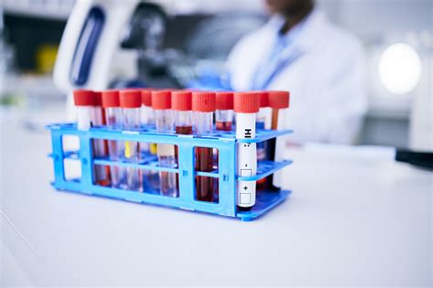 혈액 검사 과학 및 발견 실험 및 프로젝트를 통한 돌파구가 있는 의료 연구 및 바이알 과학적 혁신과 화학 액체를 갖춘 튜브 의료
