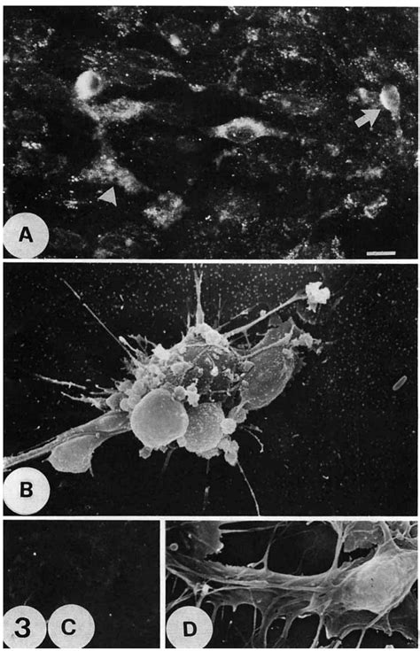 Immunocytochemical Staining Of Human Brain Cultures For