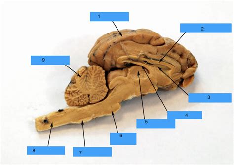 Sheep Brain Diagram Quizlet