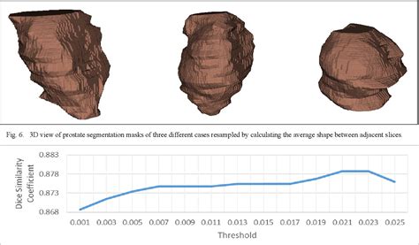 Figure 1 From Segmentation Mask Resampling For Mri Prostate