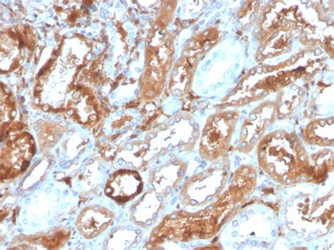 Rbp4retinol Binding Protein 4 Monoclonal Antibody Rbp4 4314 5950
