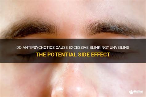 Do Antipsychotics Cause Excessive Blinking Unveiling The Potential