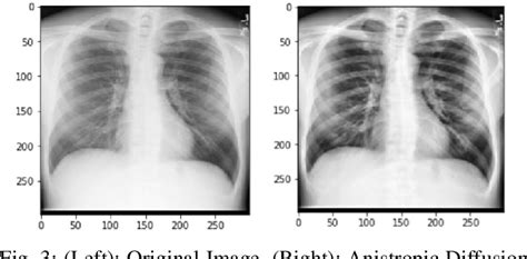 Figure 1 From An Explainable Ai Model For Interpretable Lung Disease Classification Semantic