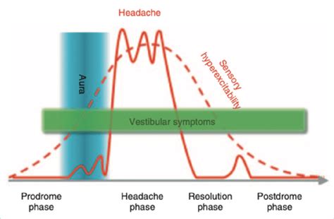 Vestibular Symptoms During A Migraine Attack Adapted From Stolte B