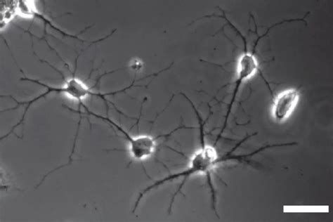 Astrocytes Ucla Medical School