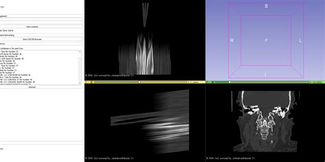 Problems During Dicom Import Support 3d Slicer Community