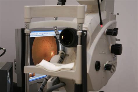 Fluorescein Angiography Testing Boca Raton And Coral Springs