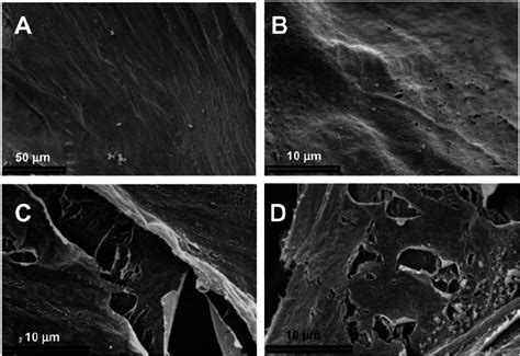 Scanning Electron Micrographs Showing Peritrophic Matrix Pm Of Fall