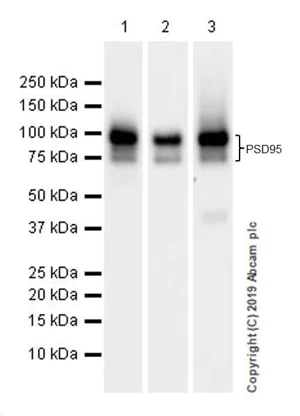 Synaptic Marker Synaptophysin Synapsin1 Psd95 Vamp2 Antibody