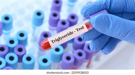 Triglycerides Test Images Stock Photos Vectors Shutterstock