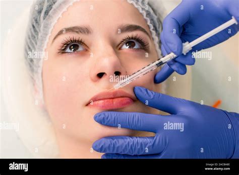 A Beautiful Woman Receives A Filler Injection On The Lips Young Woman