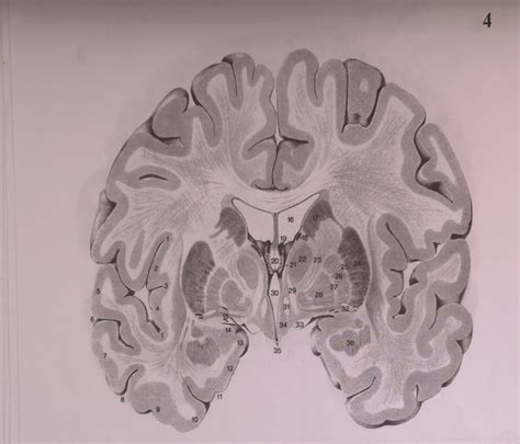 Diagram Of Coronal Slice 4 Quizlet