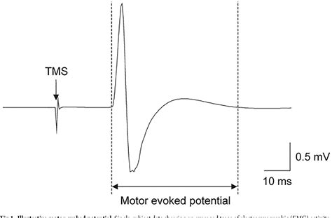 Figure 1 From What Is The Effect Of Bodily Illusions On Corticomotoneuronal Excitability A