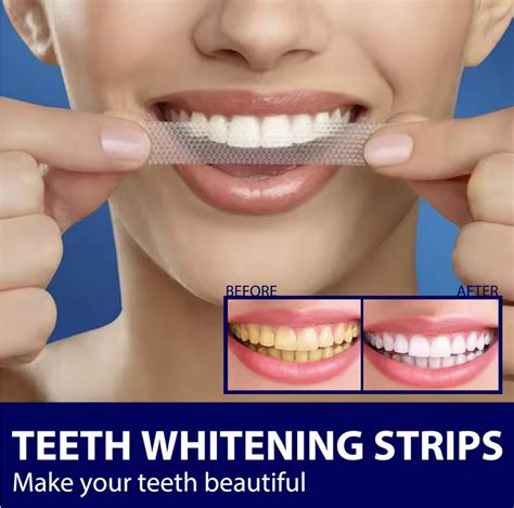 Smileluxe™ Teeth Whitening Strips Himalayan Cloud