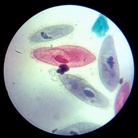 Paramecium Under Microscope 40x