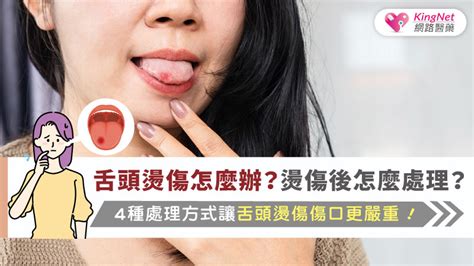 舌頭燙傷怎麼辦？燙傷後怎麼處理？4種處理方式讓舌頭燙傷傷口更嚴重！