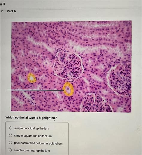 Solved N 3part Awhich Epithelial Type Is Highlightedsimple