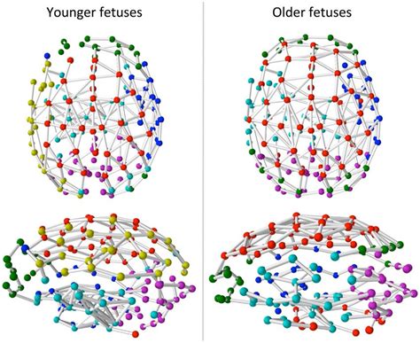 Macro Scale Functional Brain Network Modules For Younger 27 6 Download Scientific Diagram