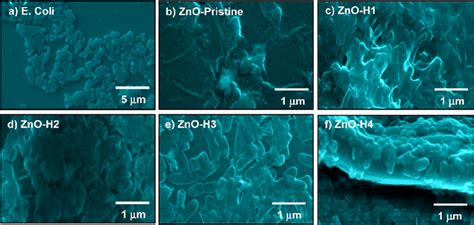Scanning Electron Micrographs Presenting The A E Coli Cells B