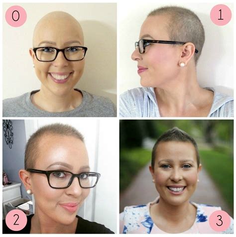 Do You Lose Your Hair With Chemo For Leukemia Semi Short Haircuts For Men