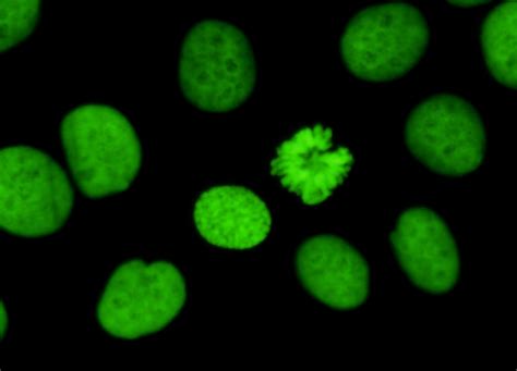 Hela Cell Histones With Fluorescein Nikons Microscopyu