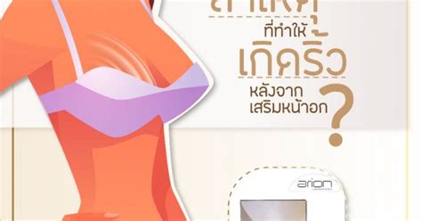 สาเหตุที่ทำให้เกิดริ้วหลังจากเสริมหน้าอก คืออะไรกันบ้างนะ อารียอง