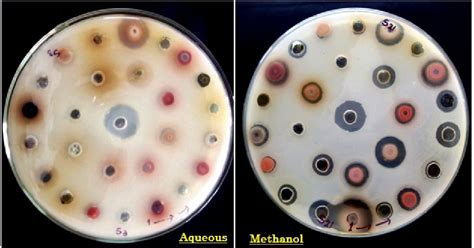 Agar Cup Method Showing Zone Of Inhibition Against V Cholerae And S