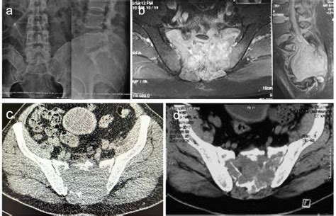 Preoperative Radiographic Examinations A B Preoperative X Ray And Mri