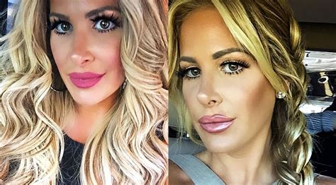 Kim Zolciak Before And After Nose Job 01 Celebrity Plastic Surgery Online