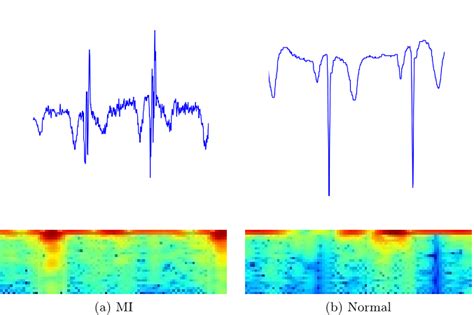 Pdf Discriminant Knowledge Extraction From Electrocardiograms For