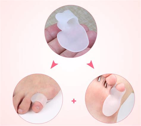 1pair 5pairs Small Toe Thumb Sebs Material Toe Cap Grandado
